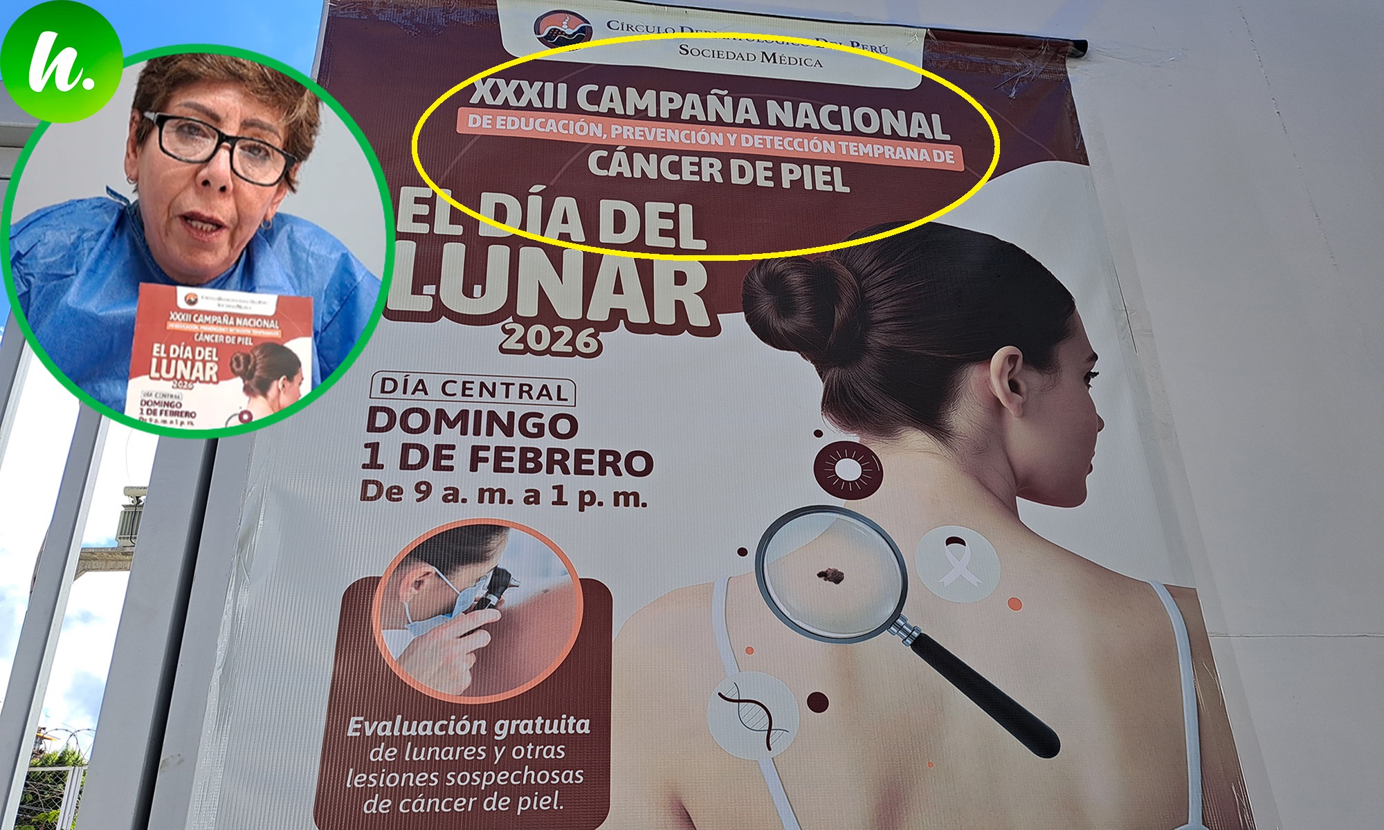 CISEA Huarupampa: Lanza campaña gratuita de cáncer a la piel
